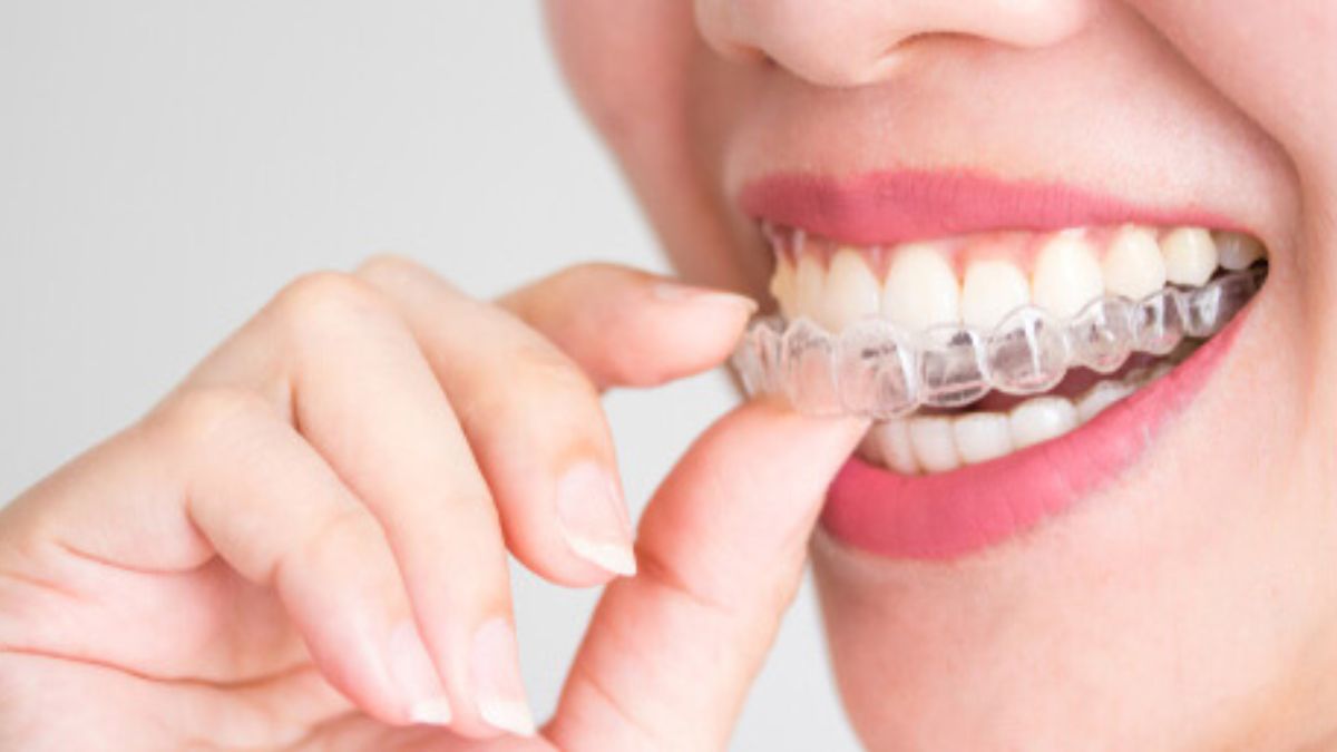 Invisalign Doctor Login: A Seamless Experience for Dental