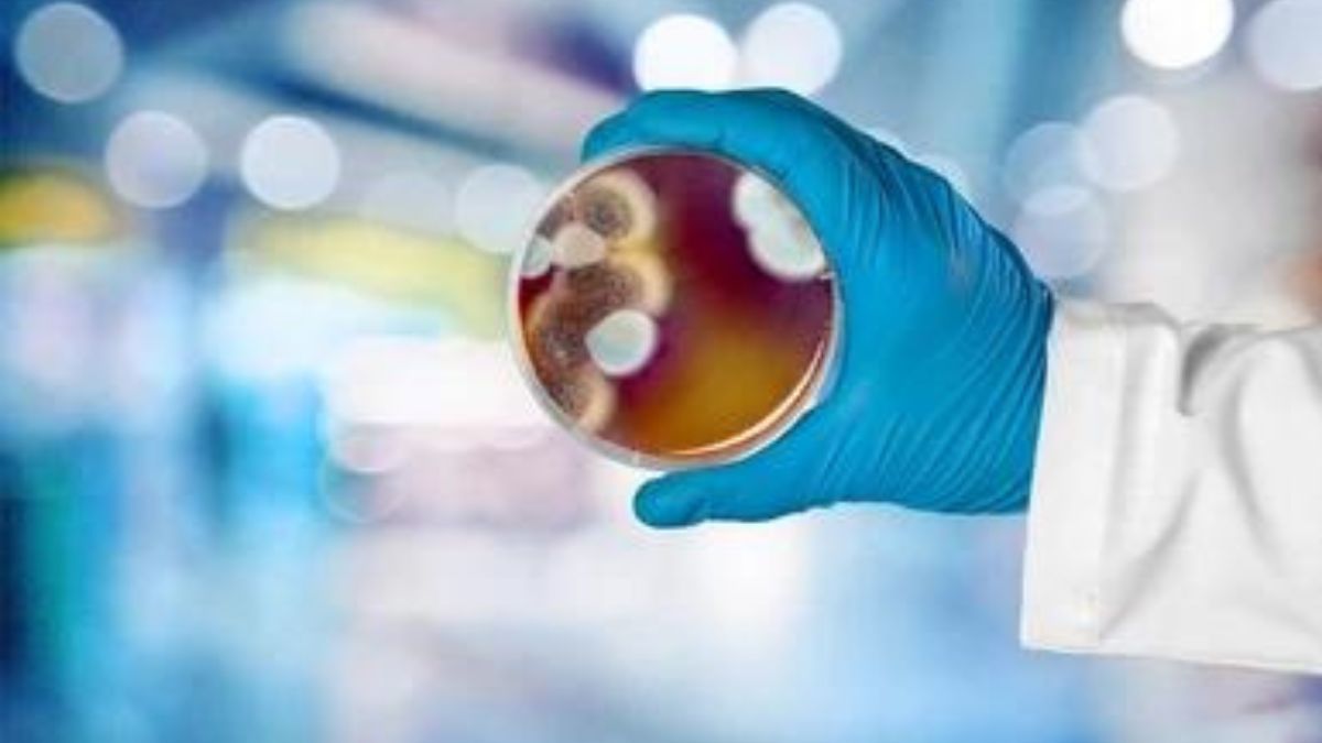 Understanding the Process of Mold Testing